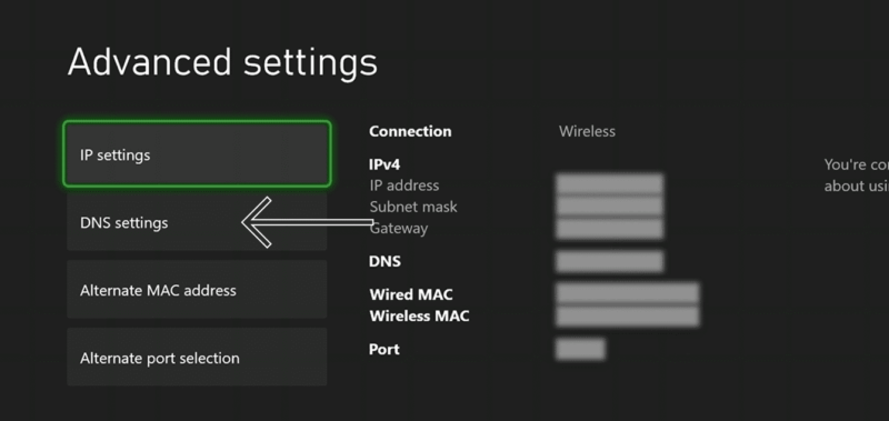 Set Up MediaStreamer on Xbox Series X or Xbox One | ExpressVPN